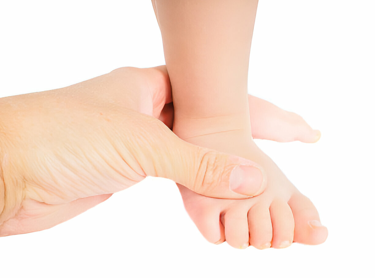 Podología Infantil en Barcelona - Clínica de Podología Pododerm